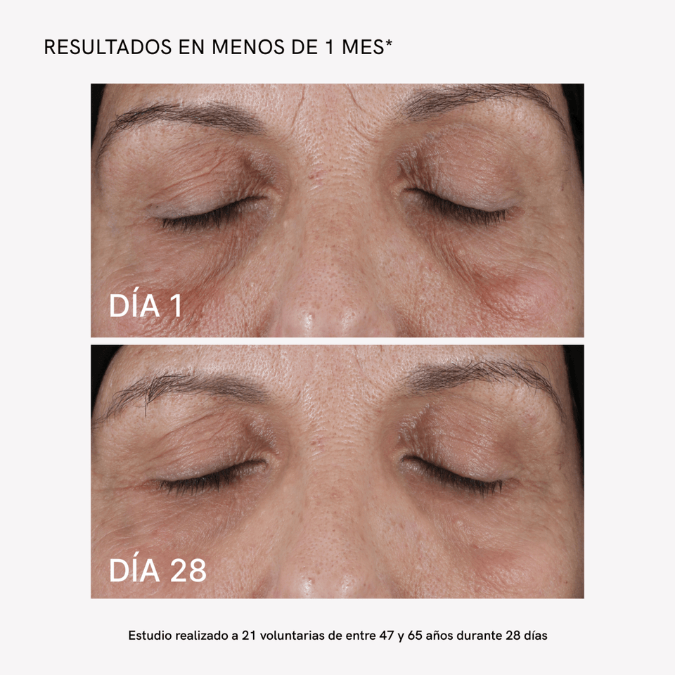 RF Face Device Plus | Dispositivo facial de Radiofrecuencia Avanzado ...